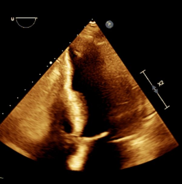 Does changing your colour map really make a difference to your ...